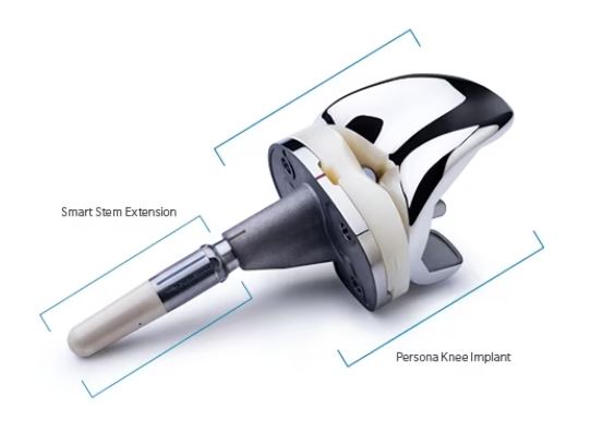 Orthopedic Surgeon Performs First Smart Knee Implant in Central Arkansas